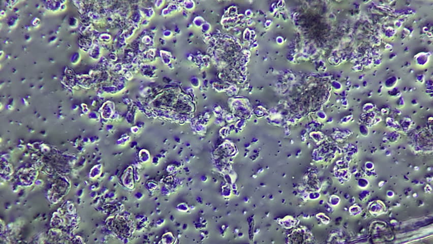 Dental Plaque From Human Sample Seen In Phase Contrast Microscope 800x ...