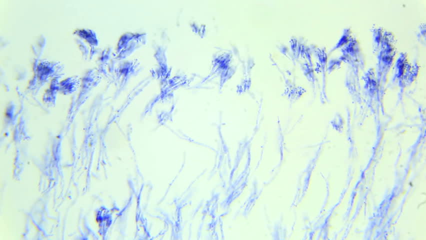 Penicillin Under The Microscope, (Penicillium W.M). Full HD Stock ...