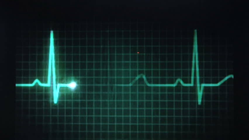 Animated EKG Display Stock Footage Video 893404 - Shutterstock